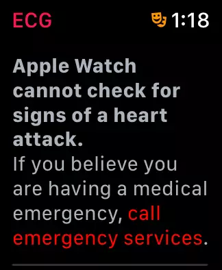 Kako napraviti EKG na Apple Watchu 22255_4
