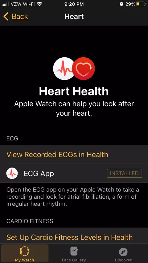 Kako napraviti EKG na Apple Watchu 22255_5